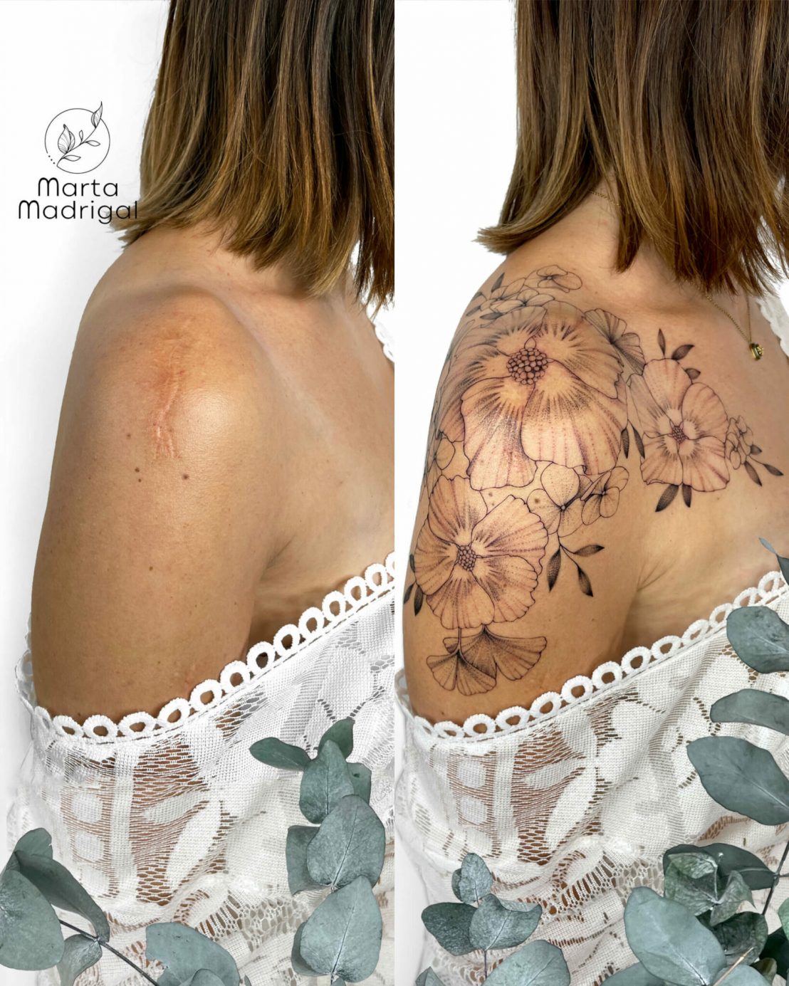Peut On Tatouer Sur Une Cicatrice