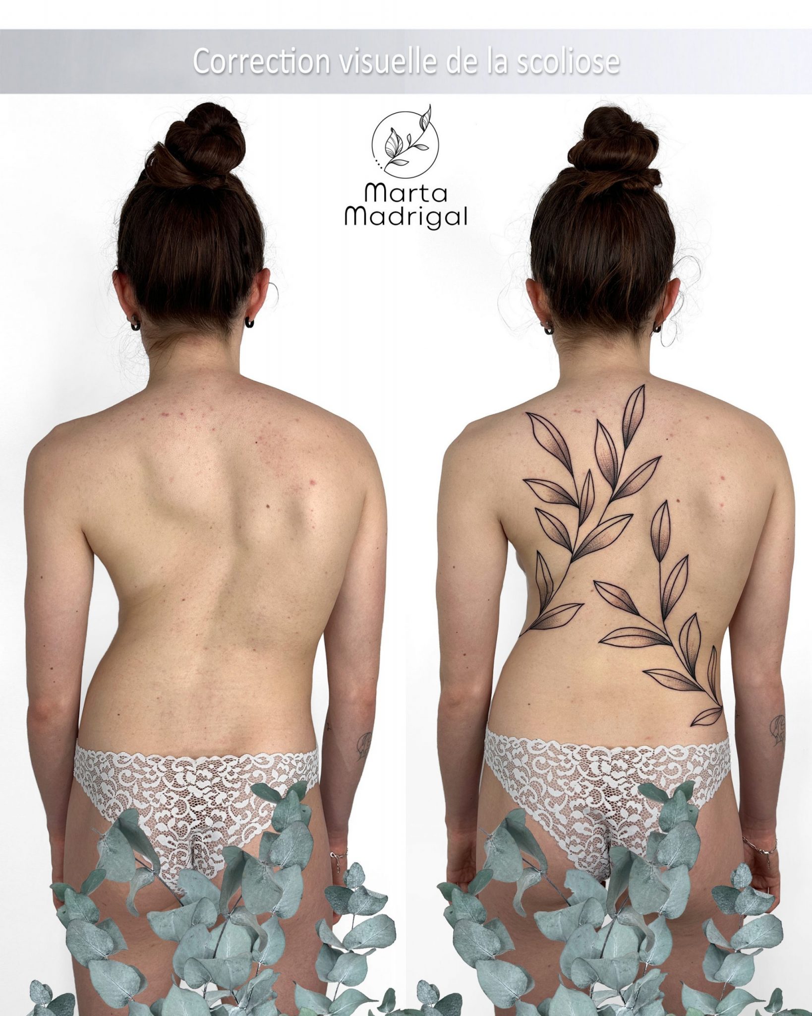 Tatouages sur cicatrices - Réparateur - brulure - Taches - lacérations